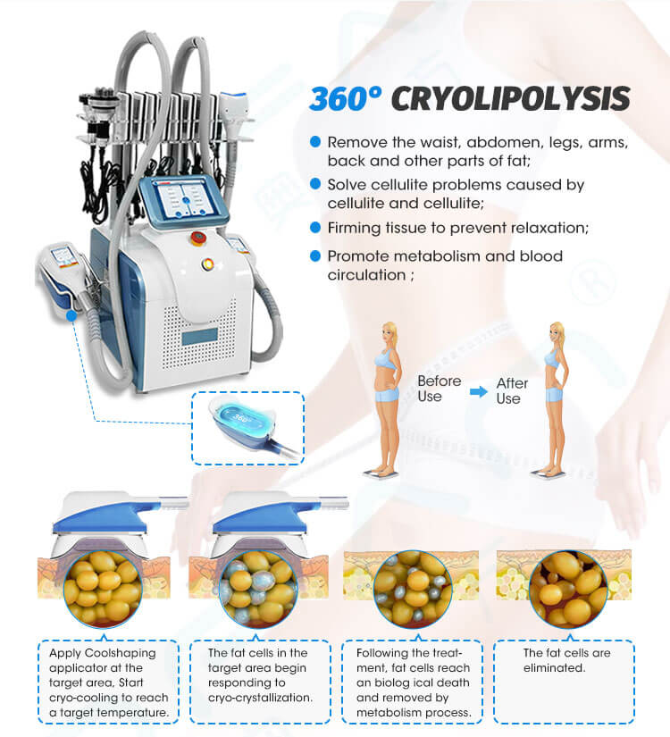 Coolsculpting Machine For Home Use - Cryo360 Portable Fat Freezing Machine